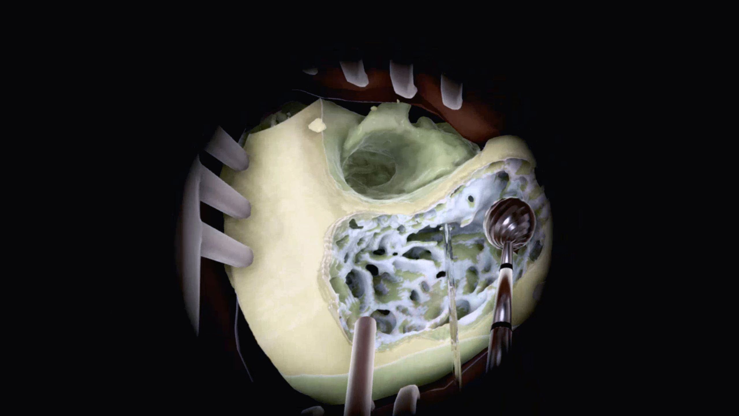 ENT VR Surgical Simulation - i3 Simulations